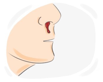 English Words for "Injury" (part 1) | LanGeek